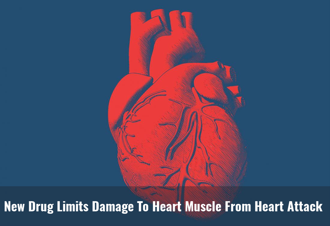 New drug limits damage to heart muscle from heart attack - CytoSolve ...