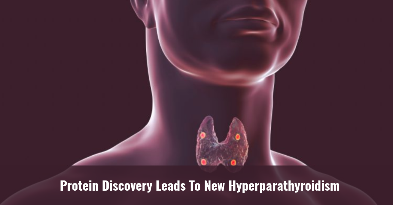 Protein discovery leads to new hyperparathyroidism - CytoSolve ...
