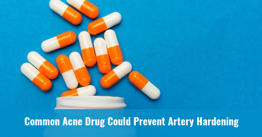 Common acne drug could prevent artery hardening - CytoSolve | Research ...